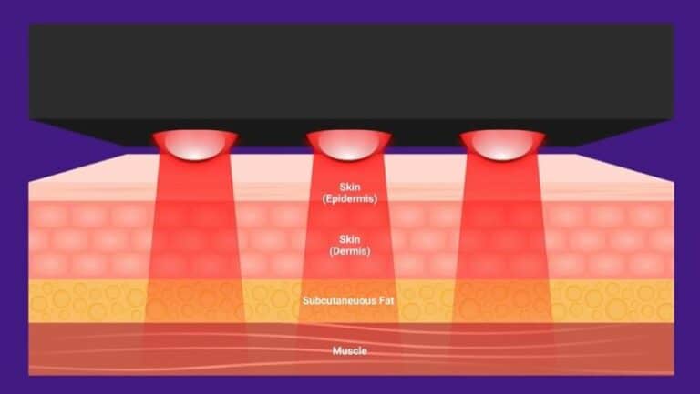 The HealthLight Red Light Therapy Pad Difference — the Value is in the ...